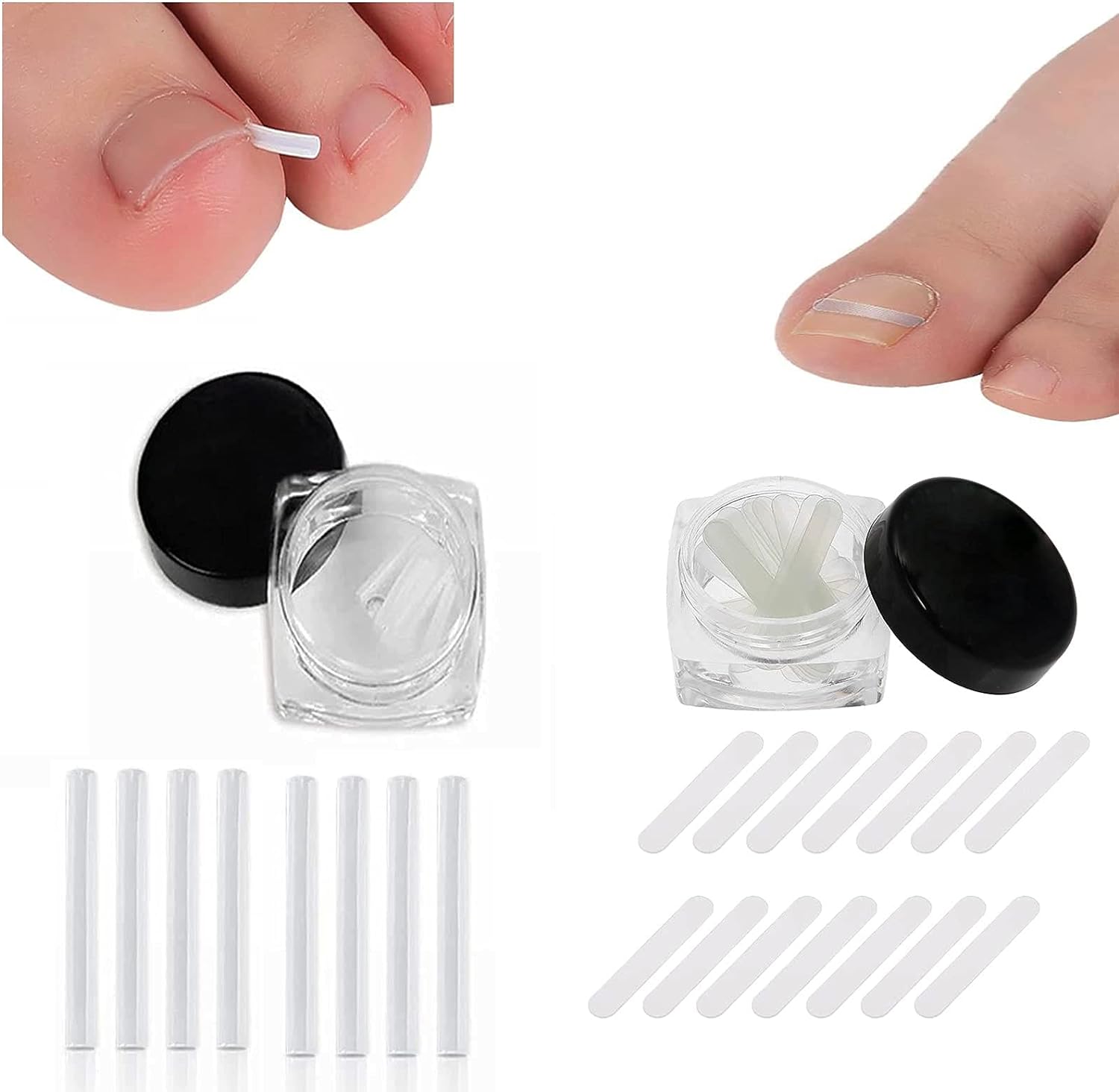 BD Ingrown Toenail Braces (1 Pair) - Beauty Depot